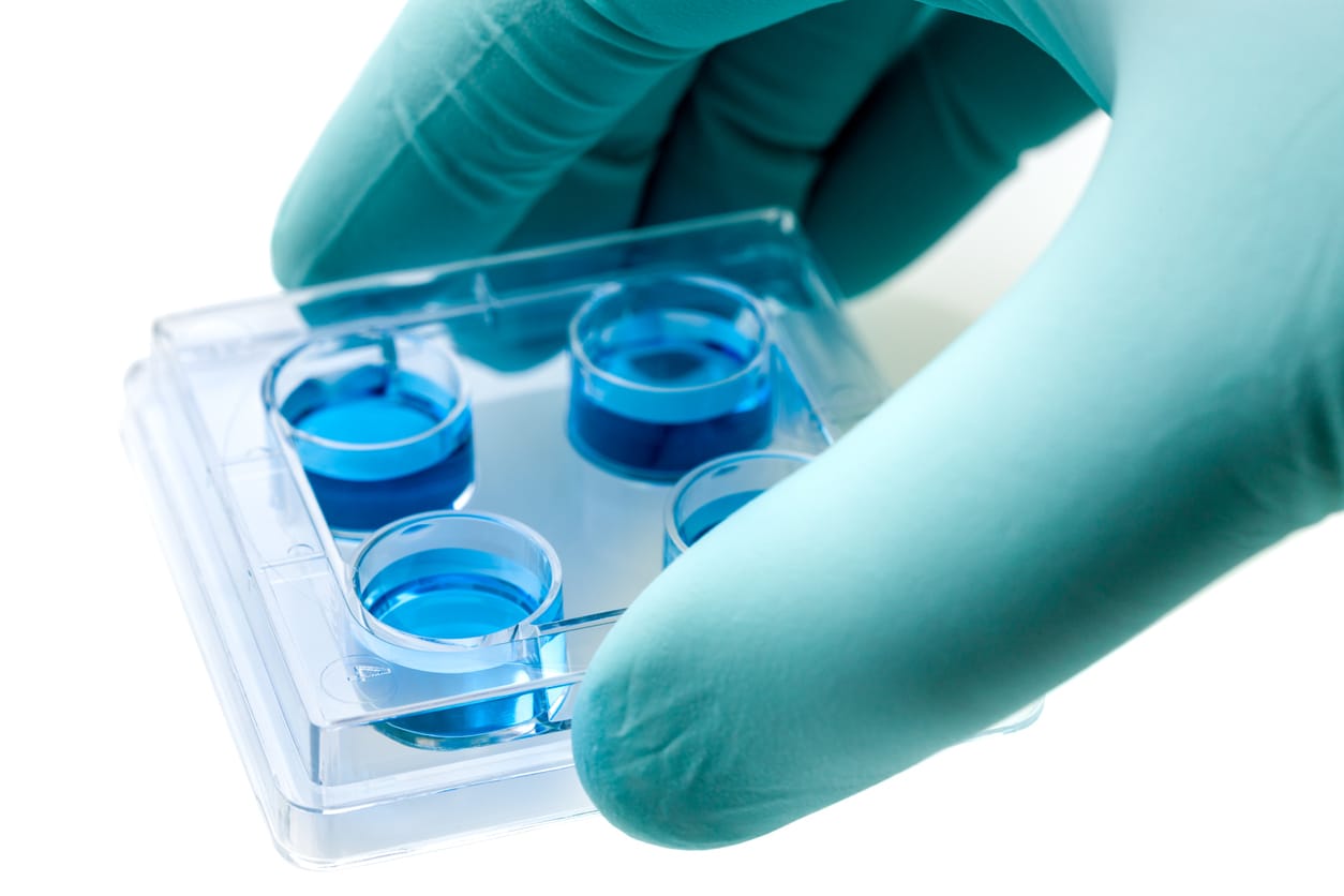 BioMed Alliance article on the implications of IVDR for innovation in ...